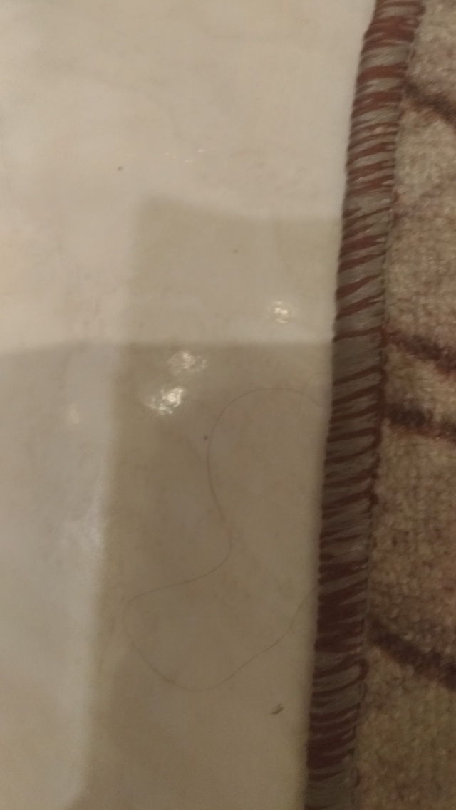 Pinworms On Toilet Paper